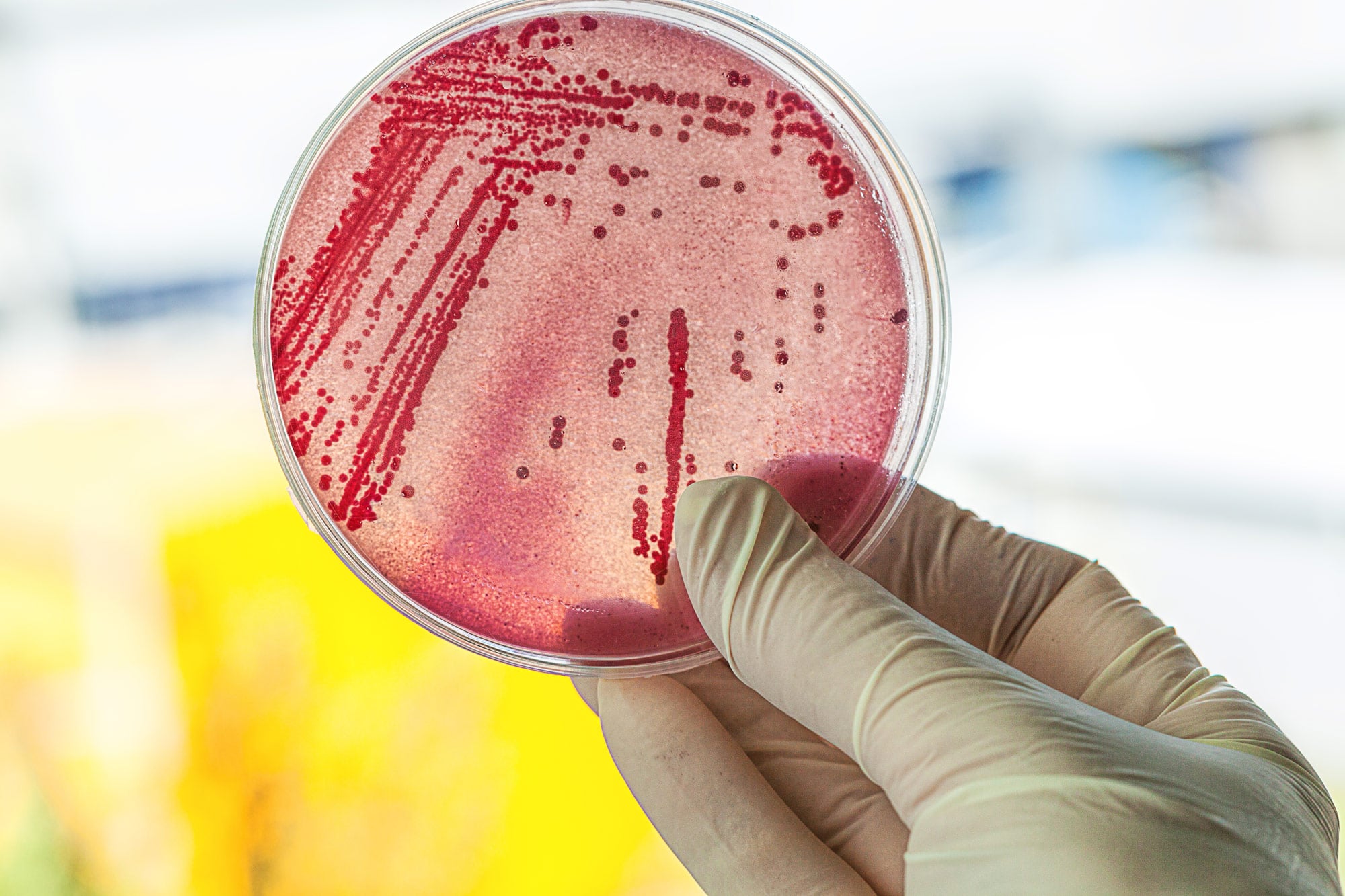 Coliform Bacteria E Coli In Drinking Water Brelje Race Labs Inc Coliform Bacteria E Coli In Drinking Water Brelje Race Labs Inc